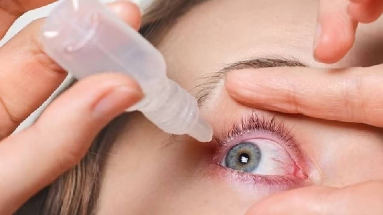 Eye Flu eye-flu