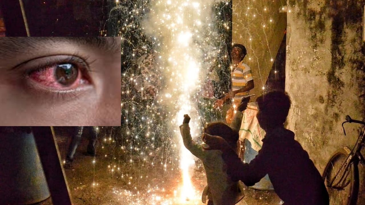 फटाक्यांपासून डोळ्यांना होणारी इजा टाळण्यासाठी 'या' कृतींचे पालन करा ...